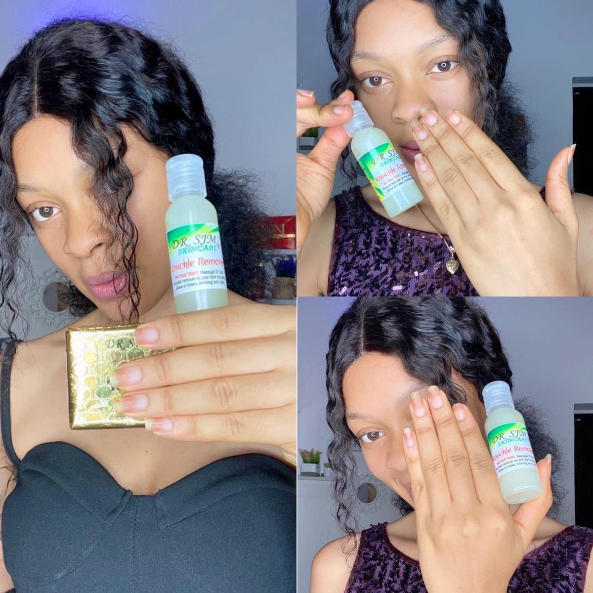 Dr SJM's Dark Knuckle Remover – Dr SJM Skincare